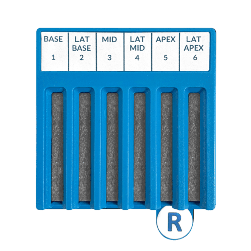 Improve Prostate Biopsies and Preserve Orientation - Lumea