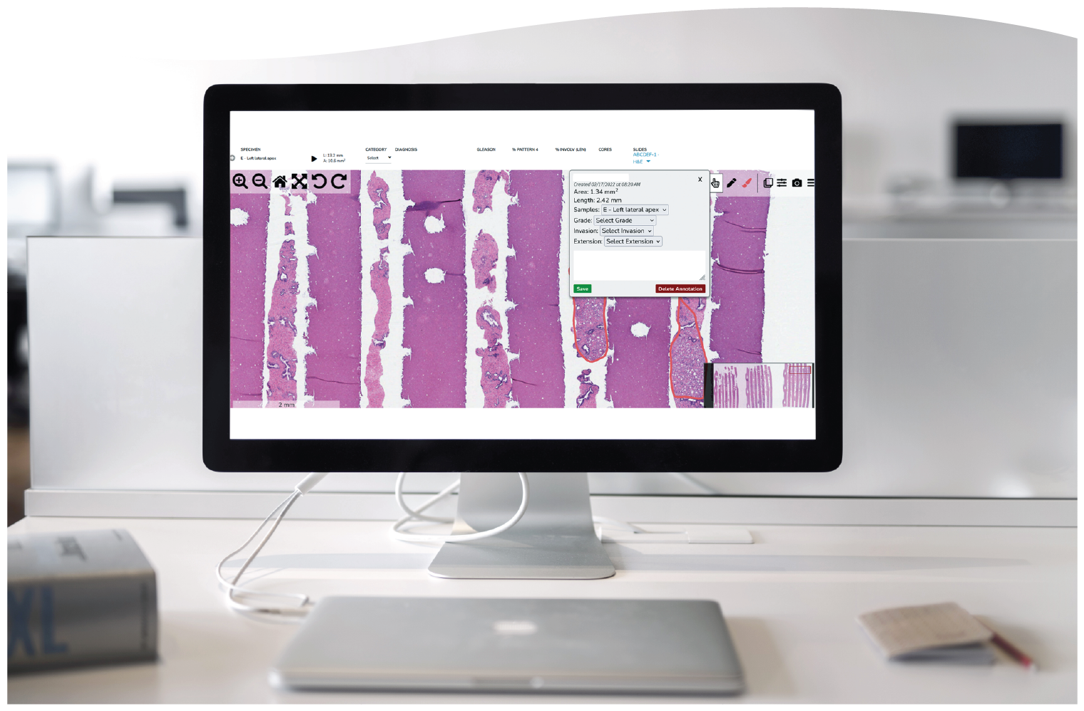 10 Components of the Best Computer for Digital Pathology