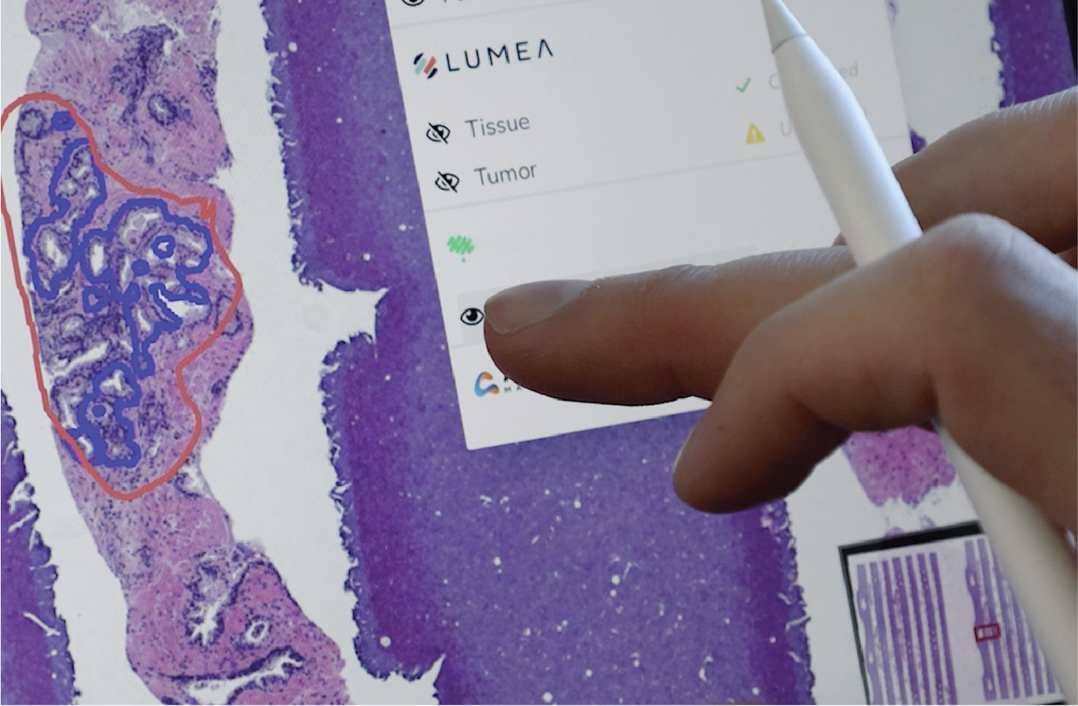 What is Digital Pathology? | Lumea