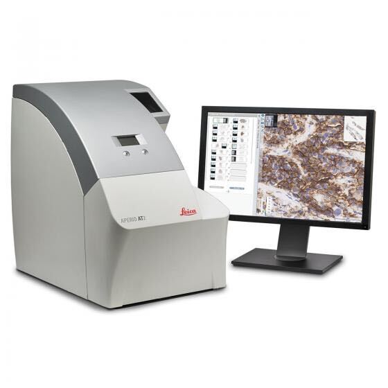 Digital Pathology Technology for Prostate Cancer | Lumea