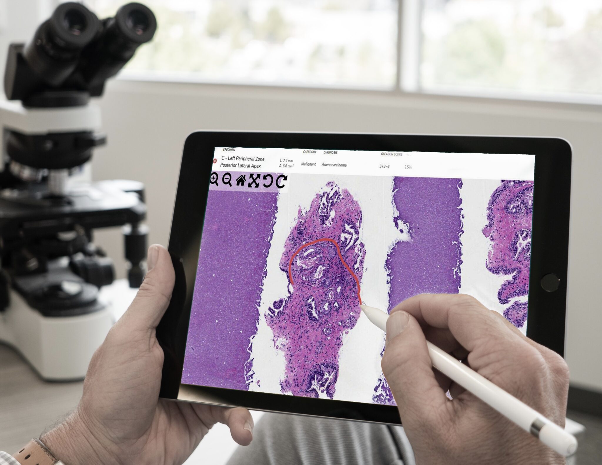 The Rise of Digital Pathology During COVID-19 | Lumea