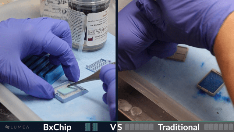 BxChip® | Lumea