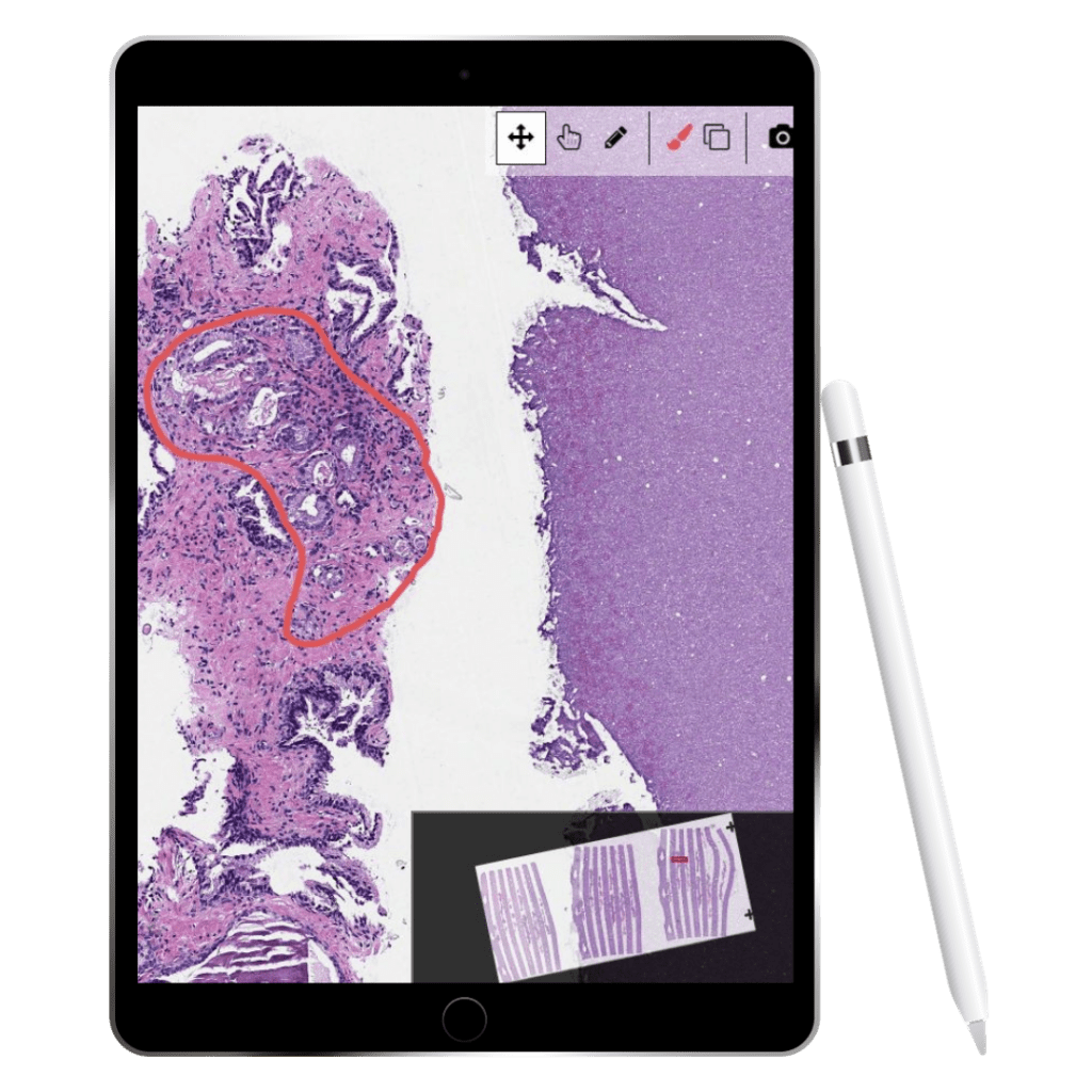 Can Digital Pathology Be More Efficient than Traditional