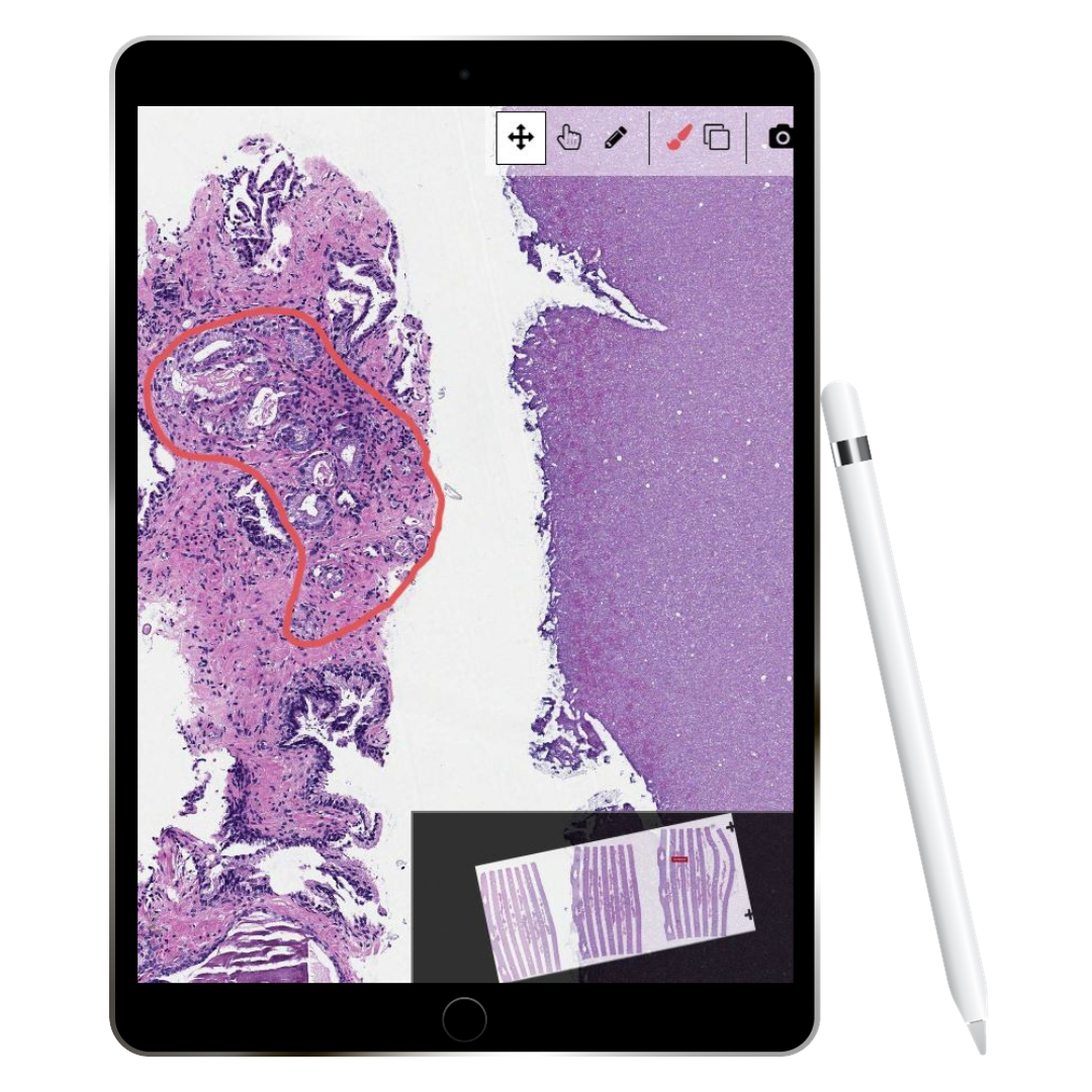 Can Digital Pathology Be More Efficient than Traditional