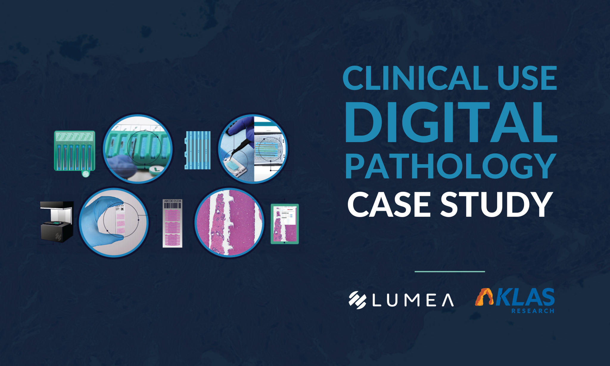 Research and Publications | Lumea