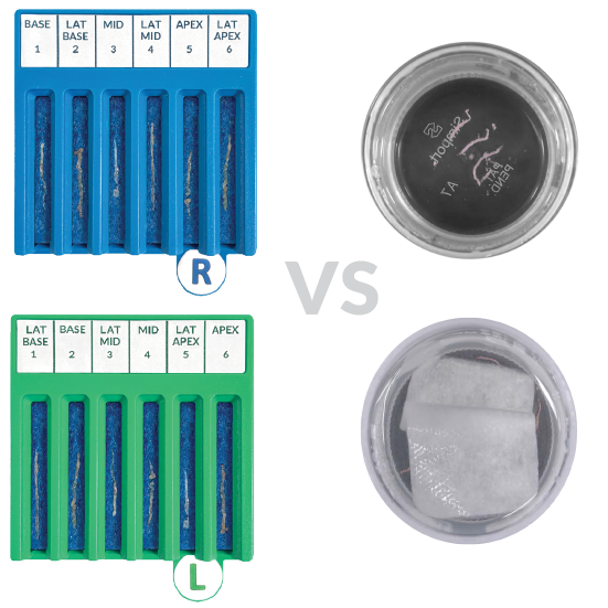 BxBoard™: The Better Biopsy | Lumea